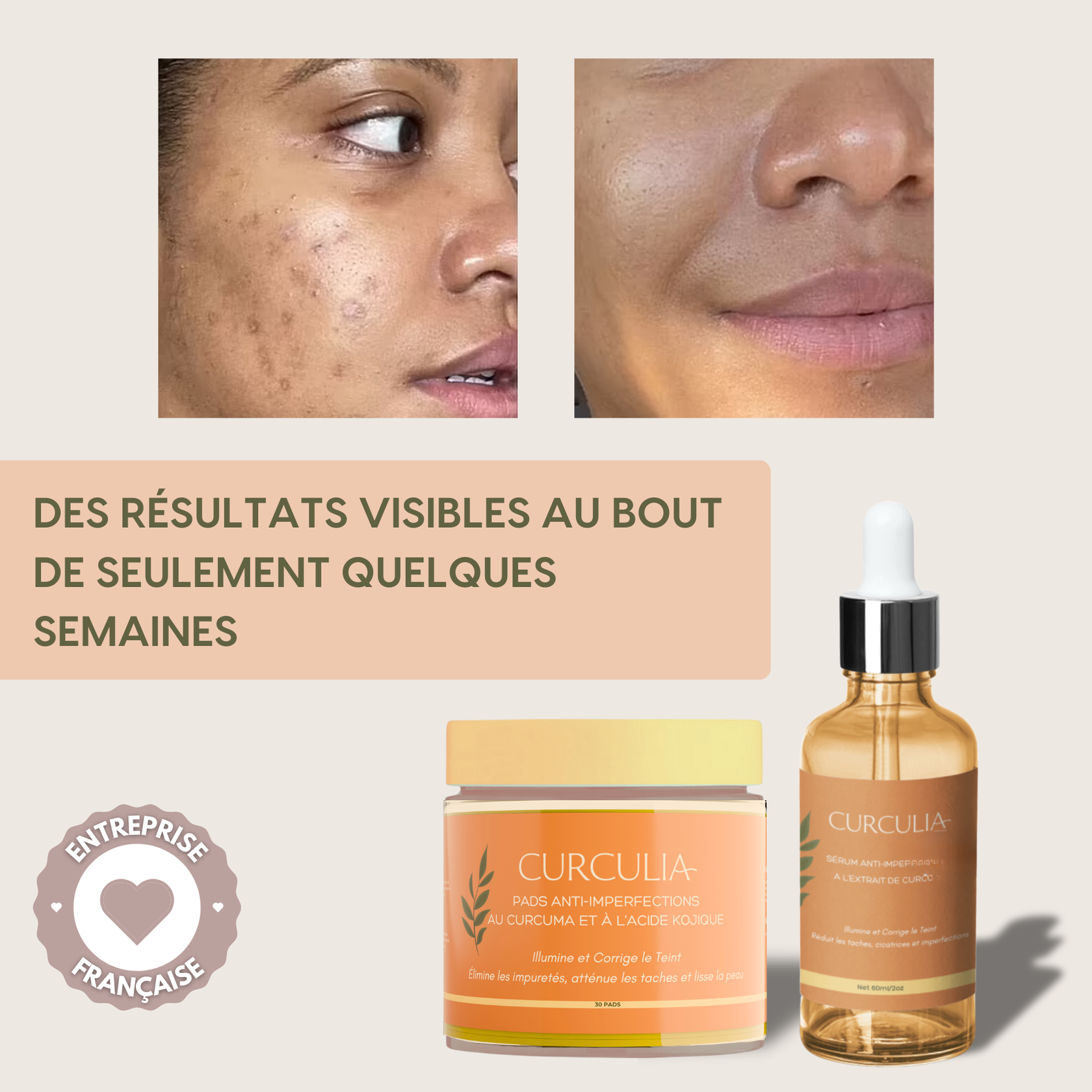 Routine Anti-Imperfections 4 en 1 – Curculia
